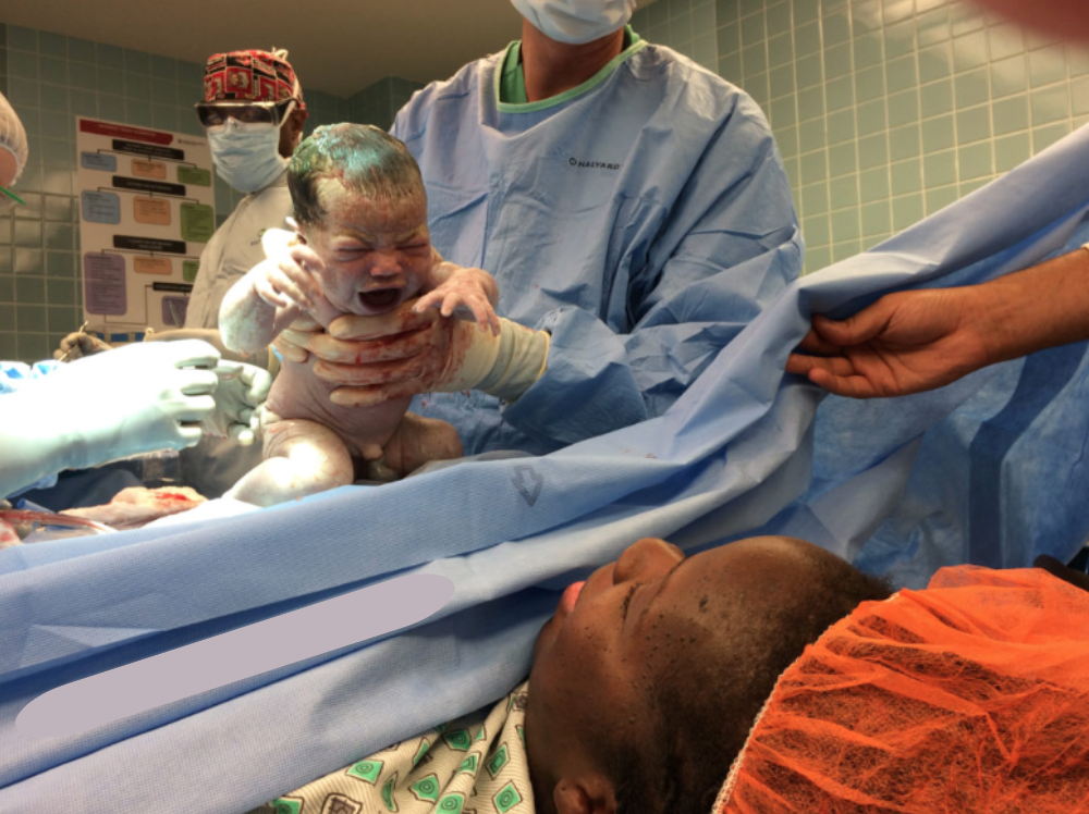 My Gentle Cesarean Section Story